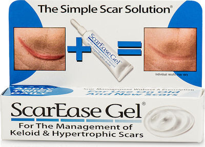 Silmax ScarEase Gel 15gr | Skroutz.gr