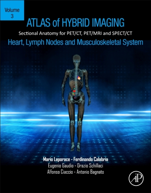 Atlas Of Hybrid Imaging Sectional Anatomy For Pet/ct, Pet/mri And Spect ...